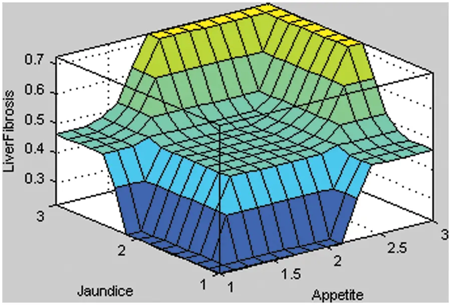CSSE | Free Full-Text | Fuzzy Logic-Based System for Liver Fibrosis Disease