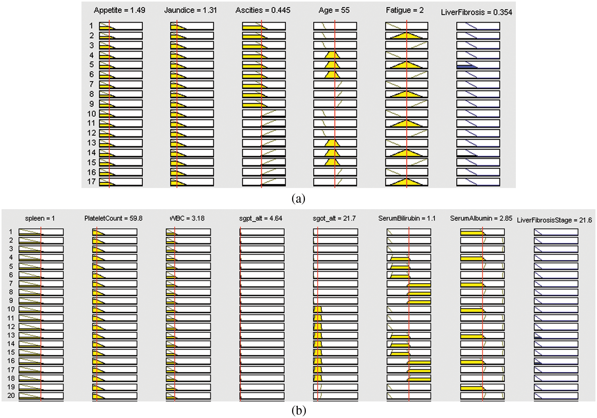 CSSE | Free Full-Text | Fuzzy Logic-Based System for Liver Fibrosis Disease