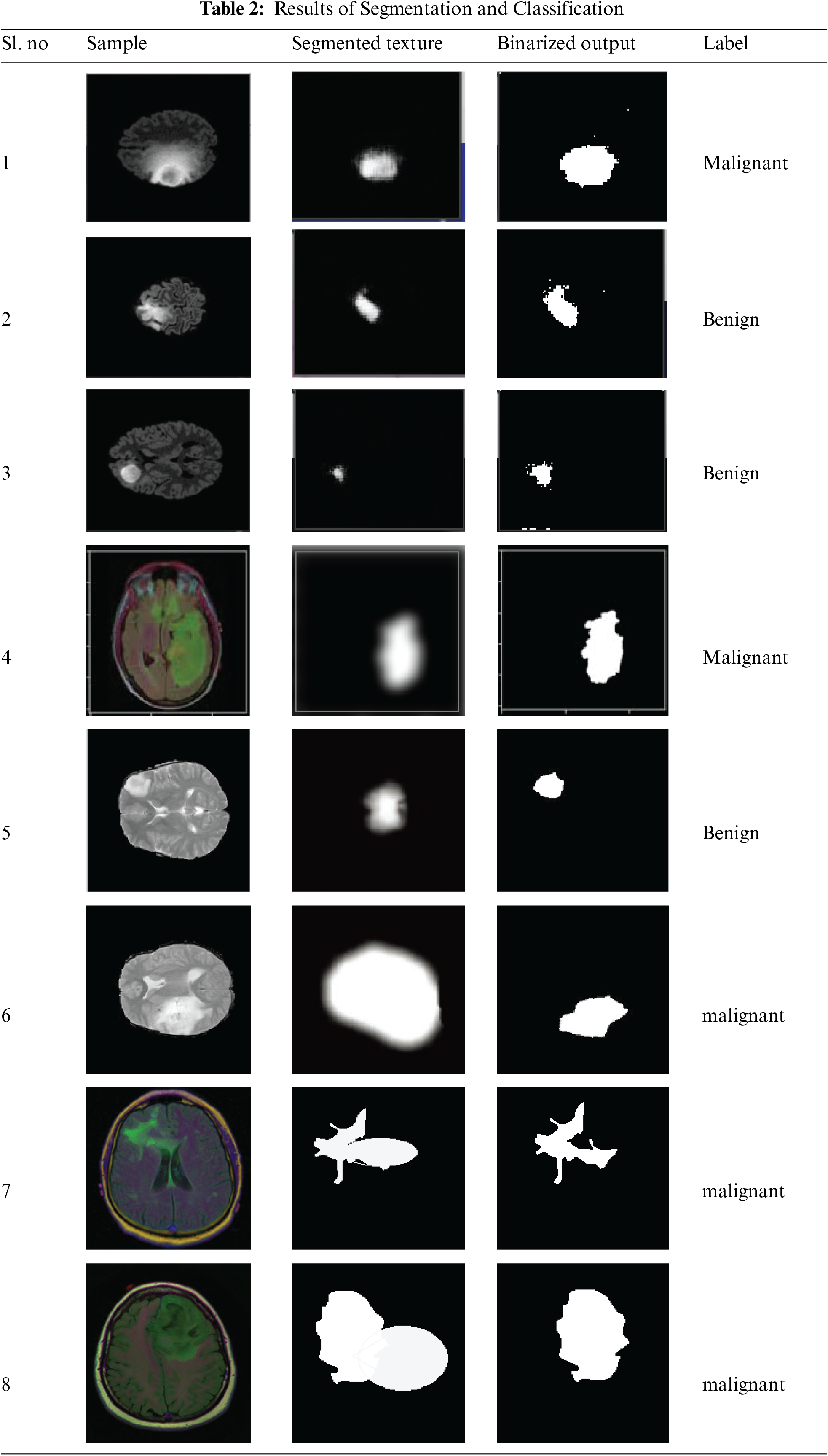 CSSE | Free Full-Text | Real-Time Multi-Feature Approximation Model-Based Efficient Brain Tumor ...