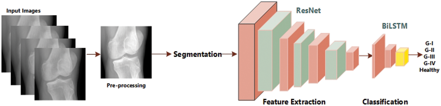 CSSE | Free Full-Text | A Robust Approach for Detection and Classification of KOA Based on ...