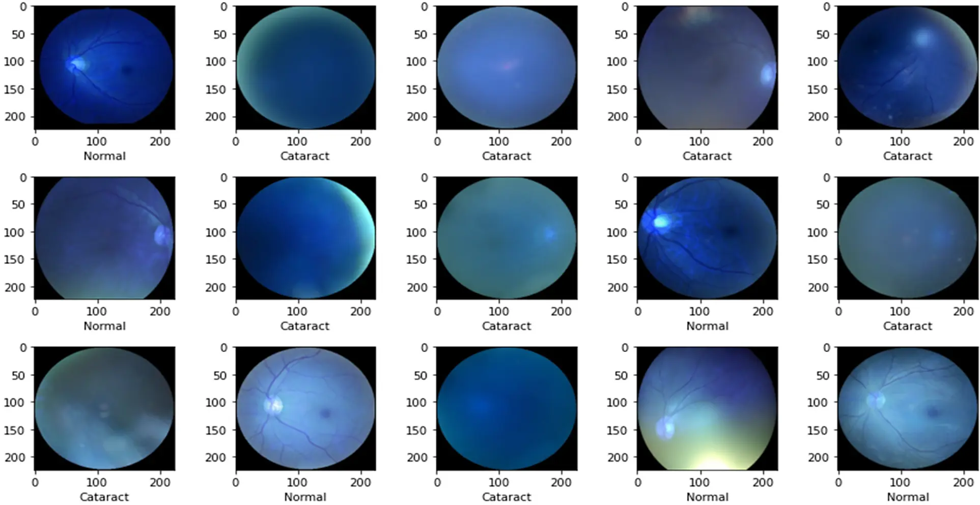 CSSE | Free Full-Text | CD-FL: Cataract Images Based Disease Detection ...