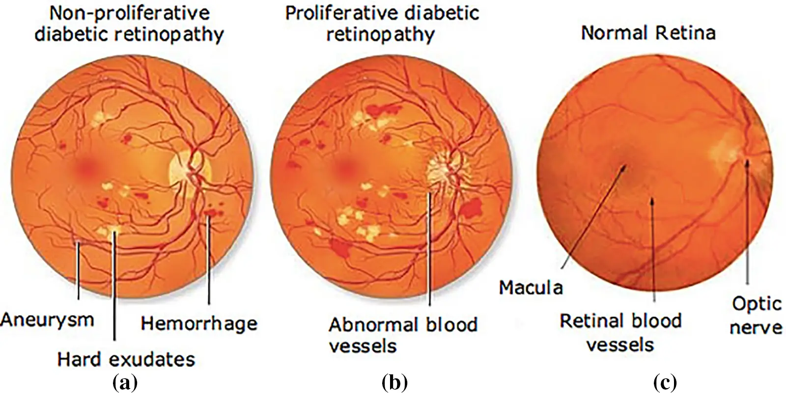 CSSE | Free Full-Text | DeepSVDNet: A Deep Learning-Based Approach for ...