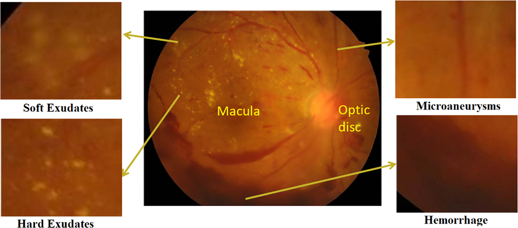CSSE | Free Full-Text | DeepSVDNet: A Deep Learning-Based Approach for ...