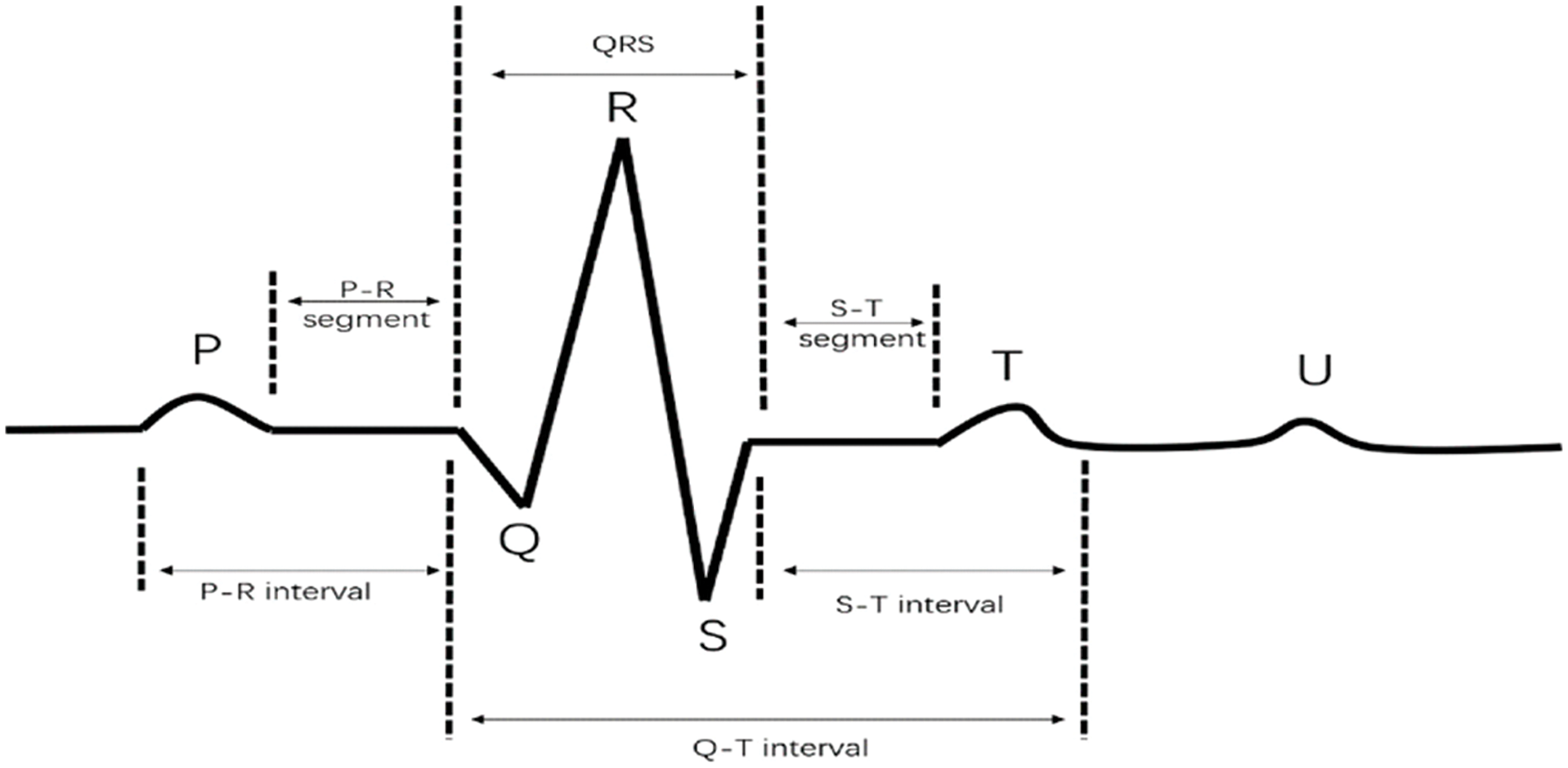 CSSE | Free Full-Text | Emotion Detection Using ECG Signals and a ...
