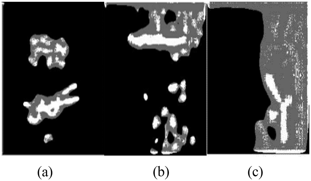 IASC | Free Full-Text | Fast Segmentation Method of Sonar Images for ...