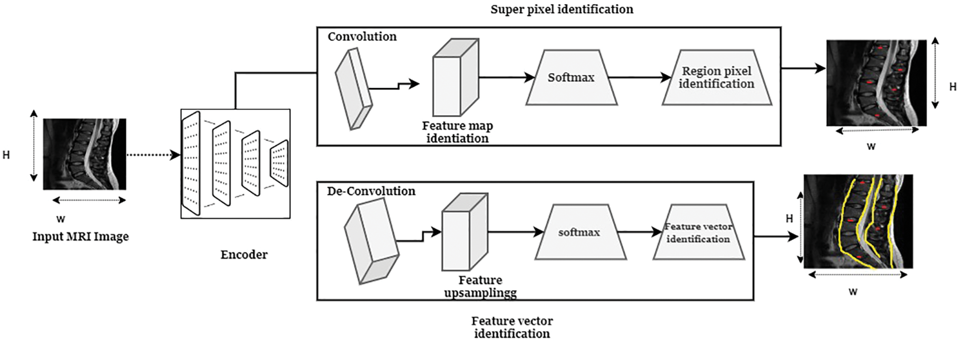 IASC | Free Full-Text | SNCDM: Spinal Tumor Detection from MRI Images ...