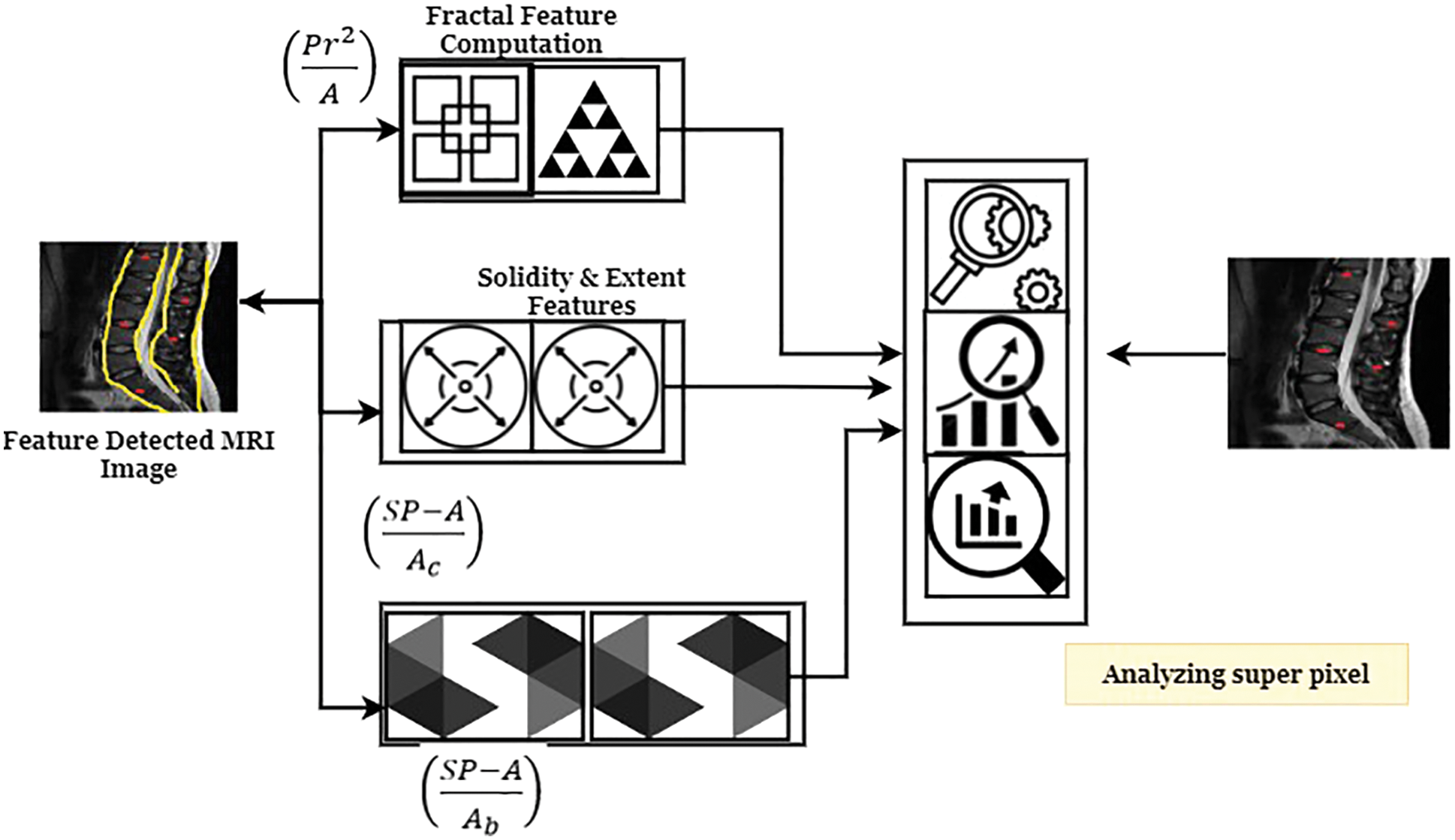IASC | Free Full-Text | SNCDM: Spinal Tumor Detection from MRI Images ...