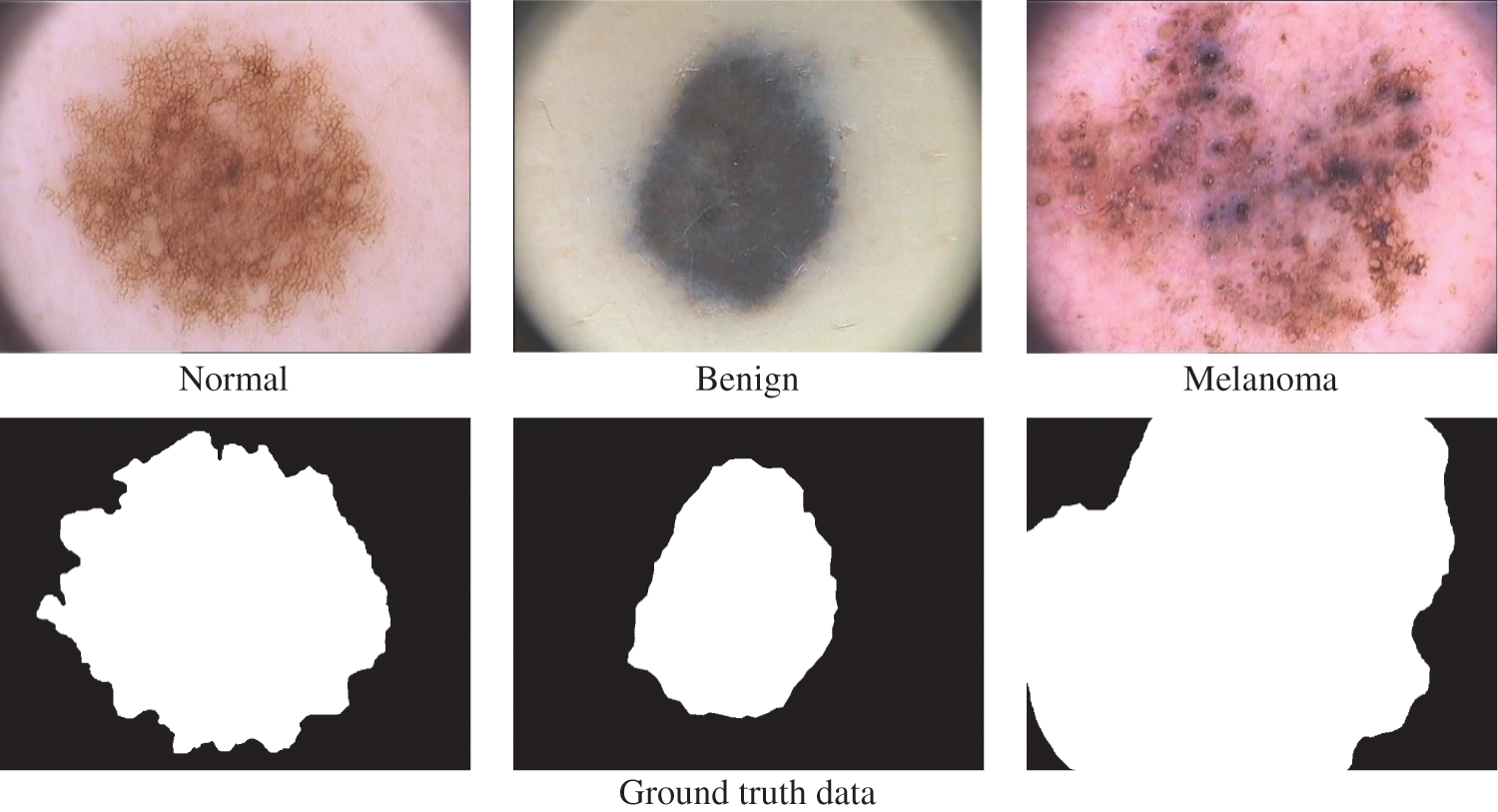 IASC | Free Full-Text | Faster Region Based Convolutional Neural Network for Skin Lesion ...