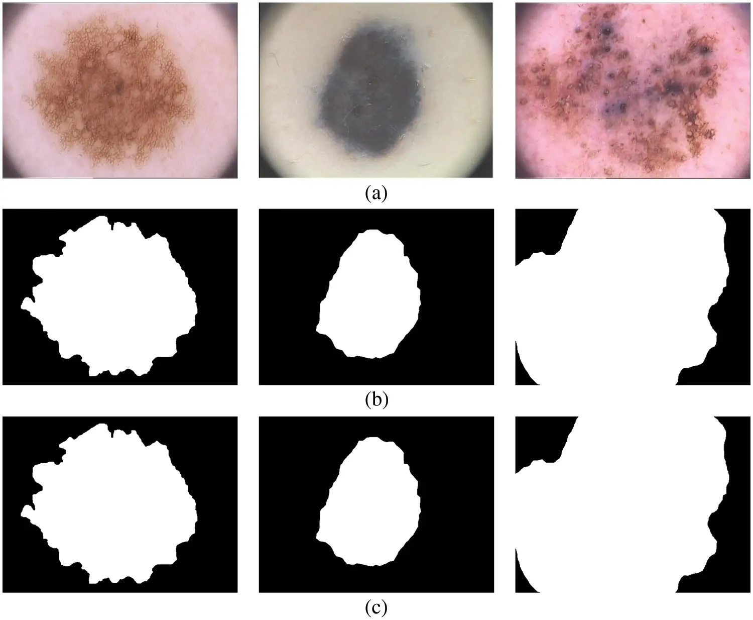 IASC | Free Full-Text | Faster Region Based Convolutional Neural Network for Skin Lesion ...