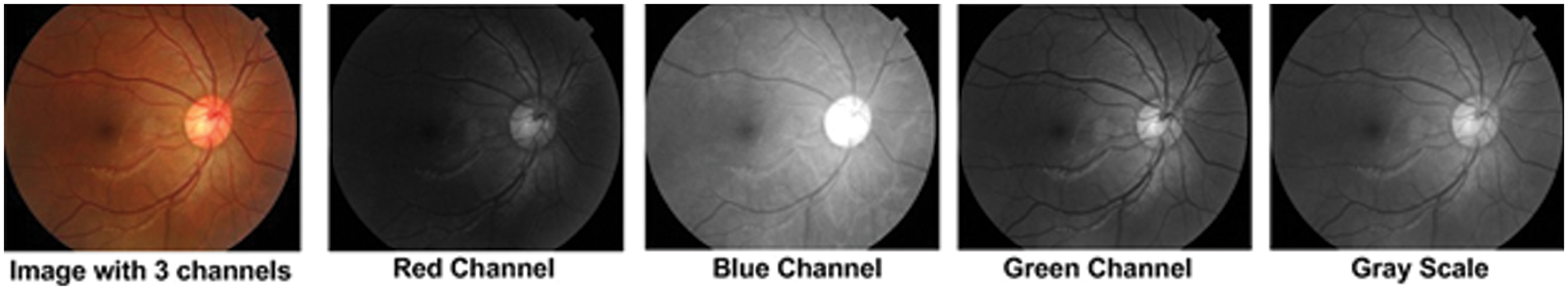 IASC | Free Full-Text | Convolutional Neural Network-Based Classification of Multiple Retinal ...