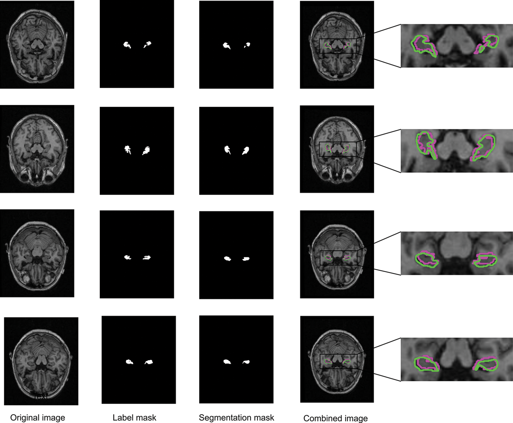 IASC | Free Full-Text | SC-Net: A New U-Net Network for Hippocampus Segmentation
