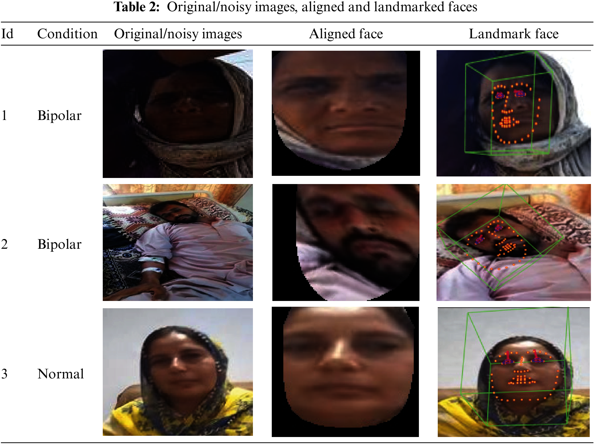 IASC | Free Full-Text | A Robust Method of Bipolar Mental Illness Detection from Facial Micro ...