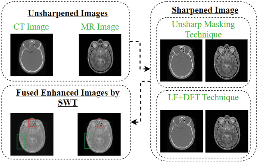 JIMH | Free Full-Text | Enhancing Multi-Modality Medical Imaging: A ...