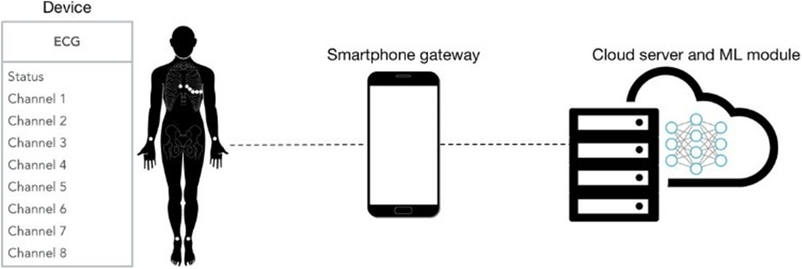 JIOT | Free Full-Text | A Detailed Study on IoT Platform for ECG Monitoring Using Transfer Learning
