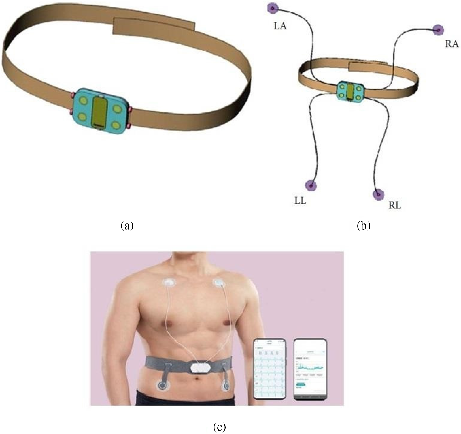 JIOT | Free Full-Text | A Detailed Study on IoT Platform for ECG ...