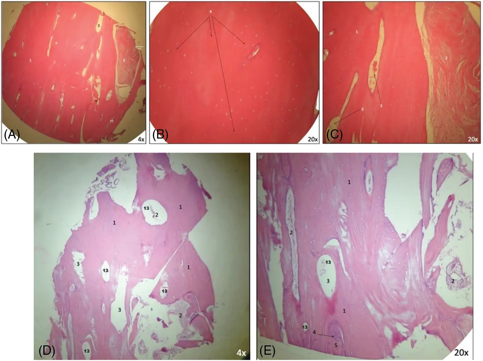 JRM | Free Full-Text | Histological Assessment of Bone Regeneration in ...