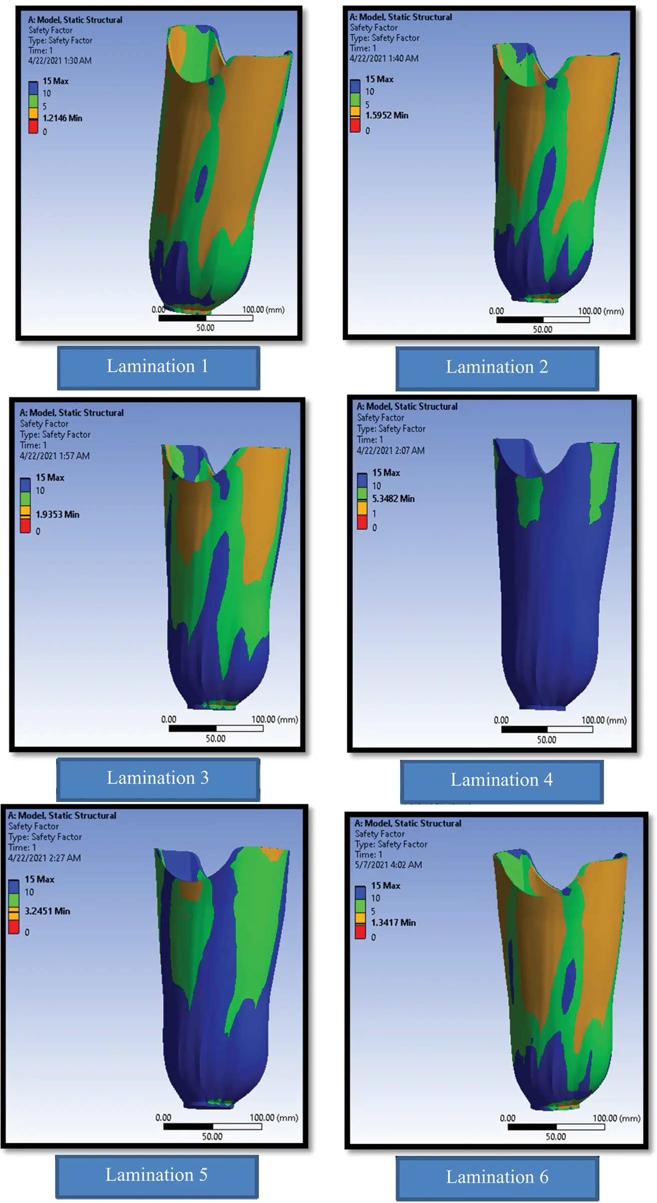 Tensile and Stress Analysis of Hybrid Composite Prosthetic Socket ...