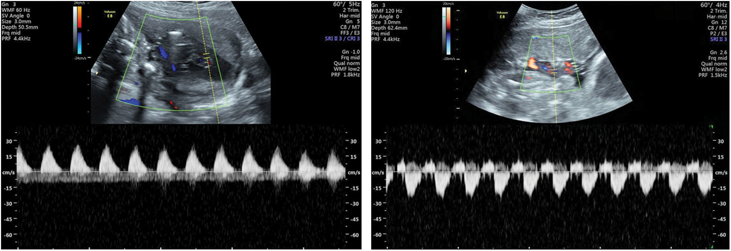 MCB | Free Full-Text | Current Perspectives on Umbilical Cord ...