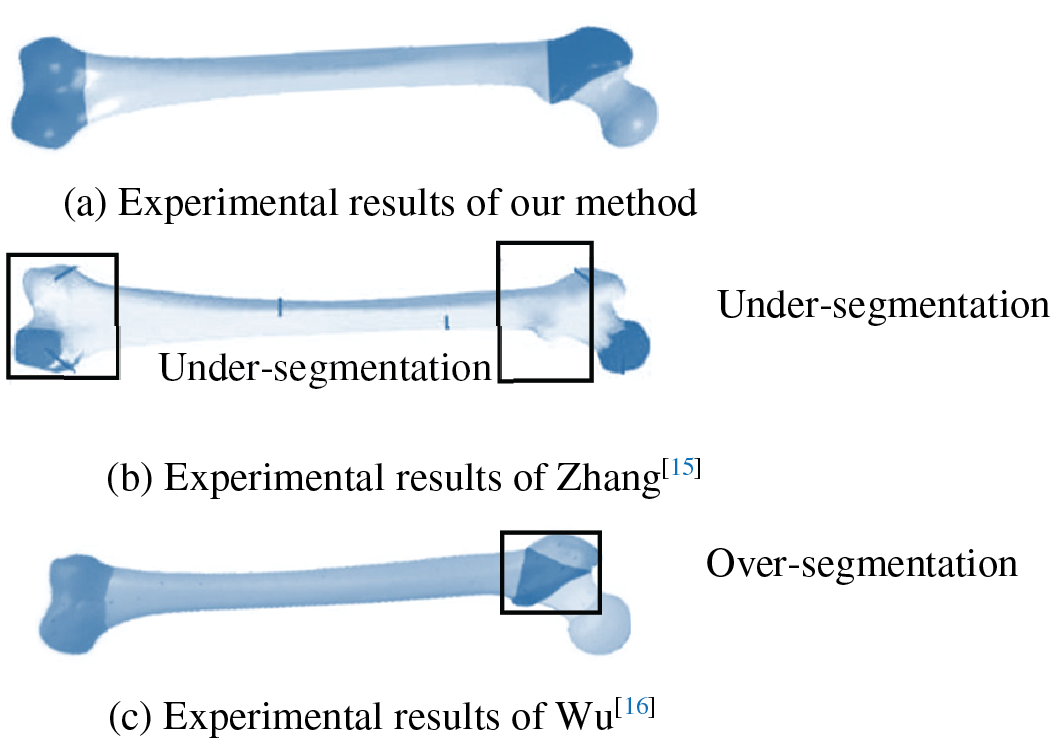 MCB | Free Full-Text | Anatomical Feature Segmentation of Femur Point Cloud Based on Medical ...