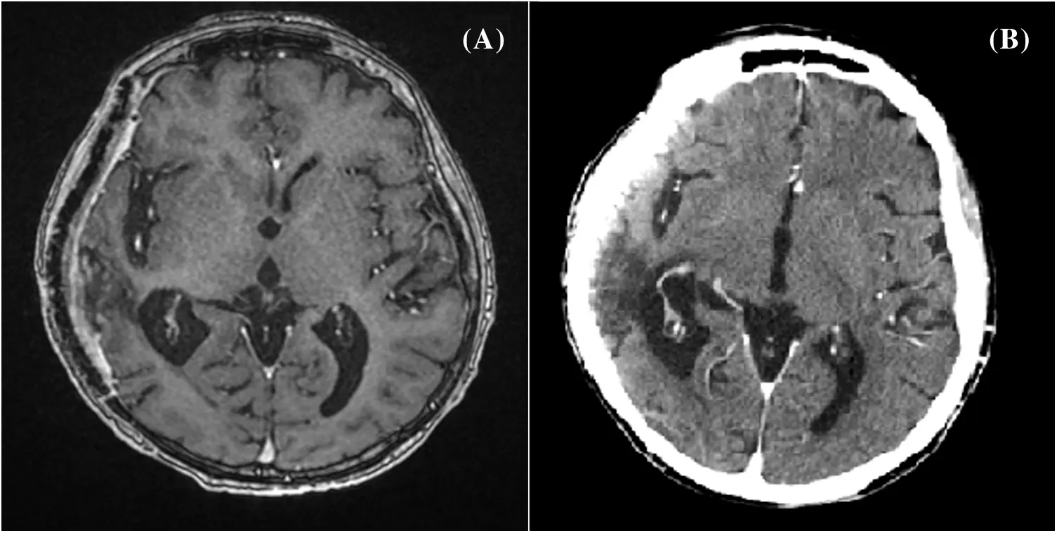 ONCOLOGIE | Free Full-Text | Differential Diagnosis between Primary ...