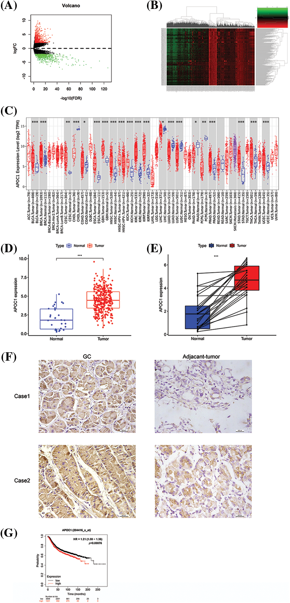 OR | Free Full-Text | Apolipoprotein C1 promotes tumor progression in ...