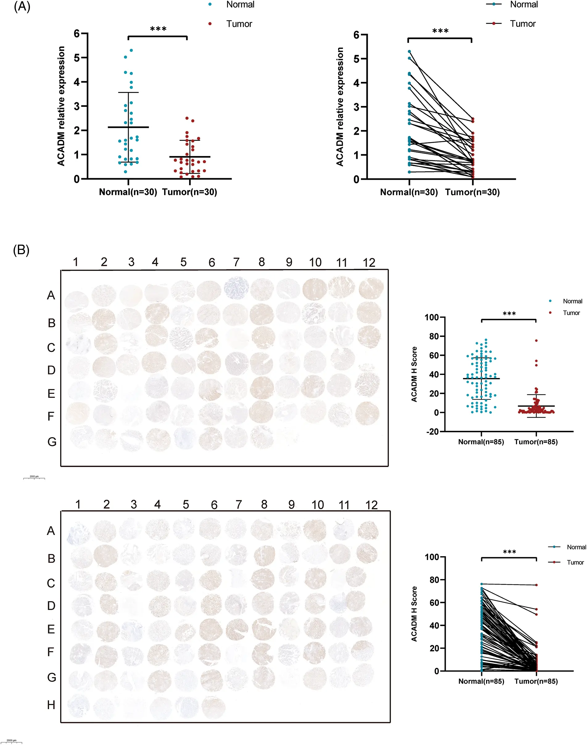 OR | Free Full-Text | Low expression of fatty acid oxidation related ...