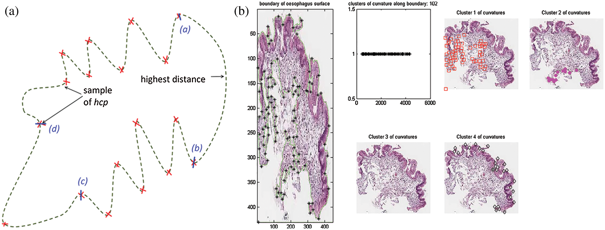 Epithelial Layer Estimation Using Curvatures And Textural Features For Dysplastic Tissue Detection