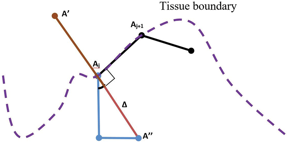 Epithelial Layer Estimation Using Curvatures And Textural Features For Dysplastic Tissue Detection