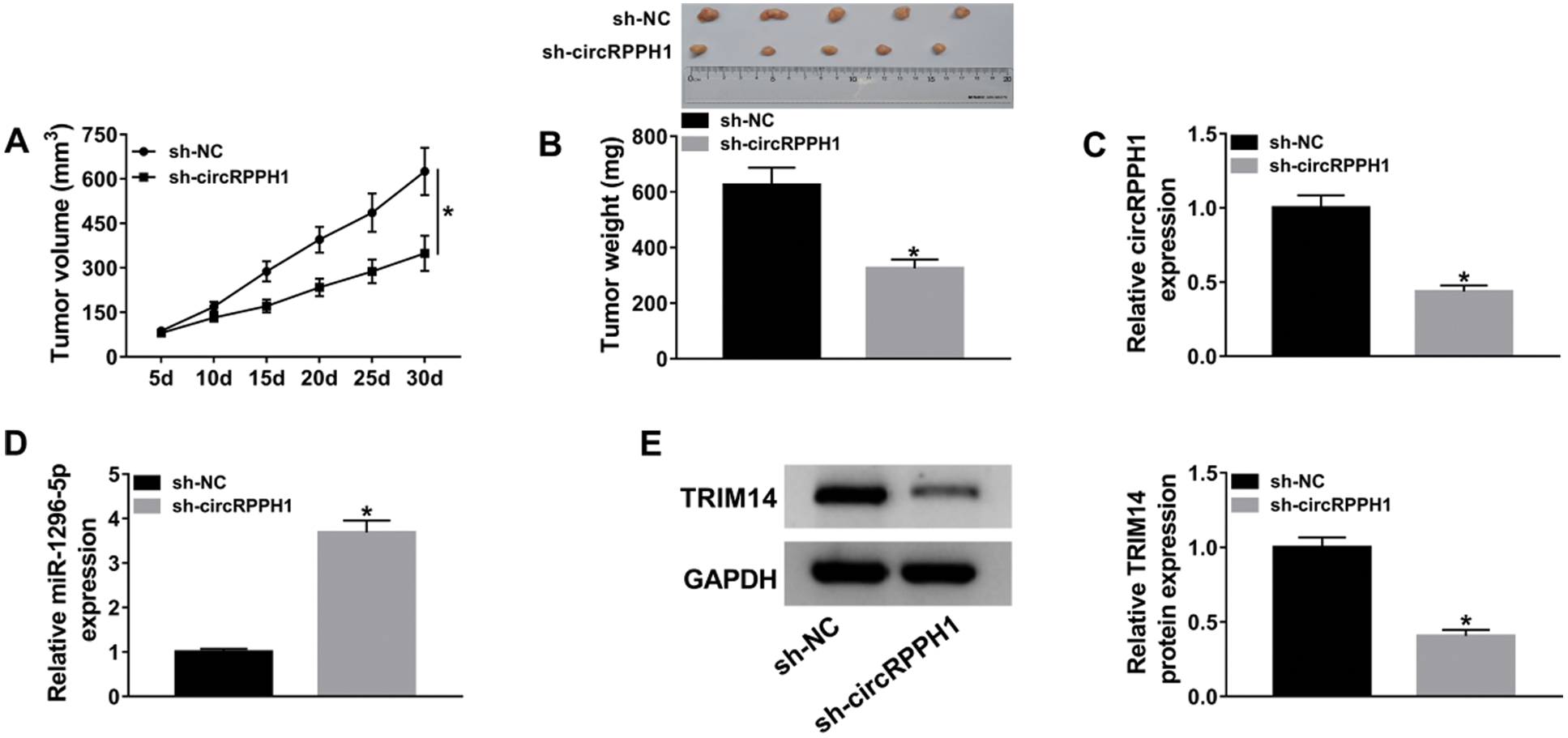 Hypoxia-associated circular RNA RPPH1 modulates triple-negative breast ...