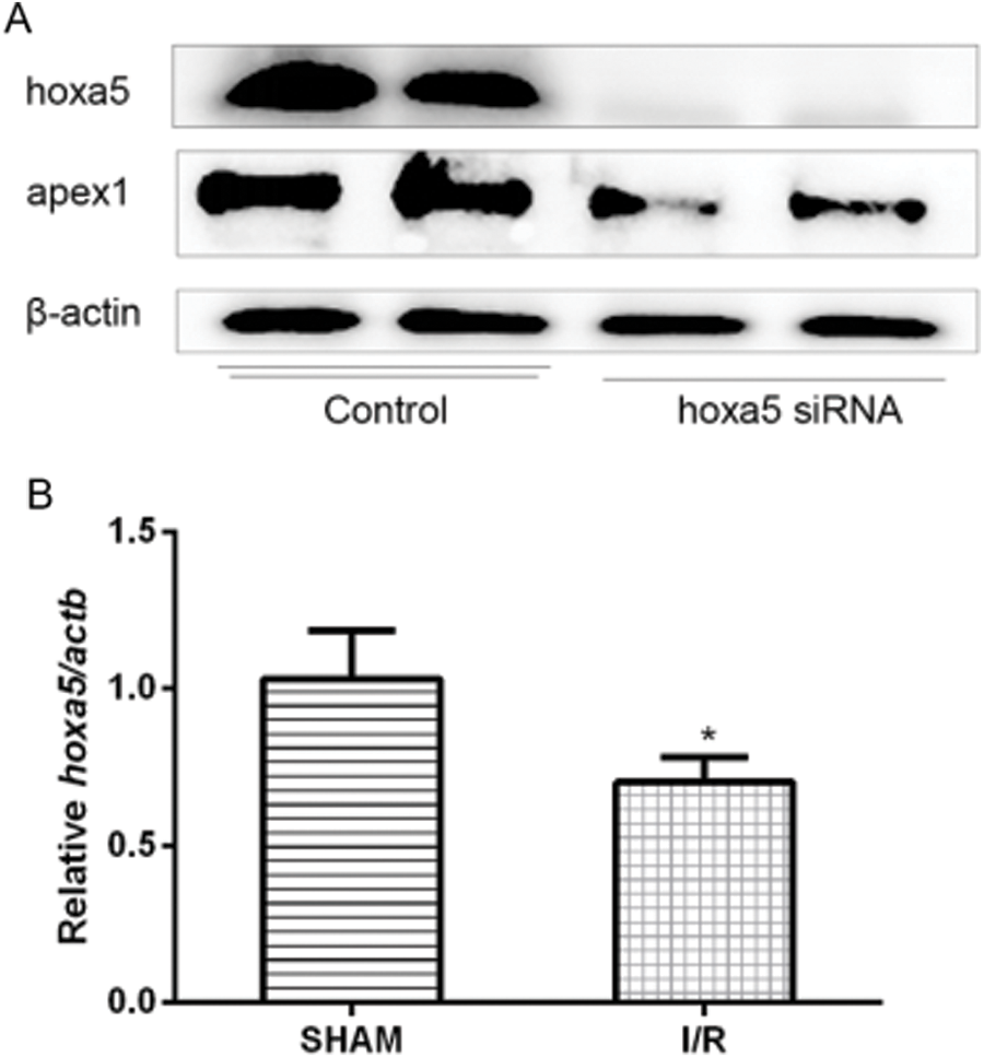 APEX1 protects against oxidative damage-induced cardiomyocyte apoptosis