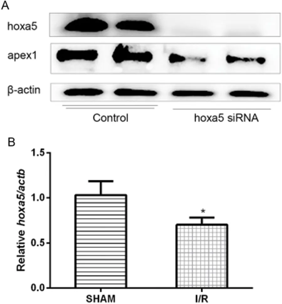 APEX1 protects against oxidative damage-induced cardiomyocyte apoptosis