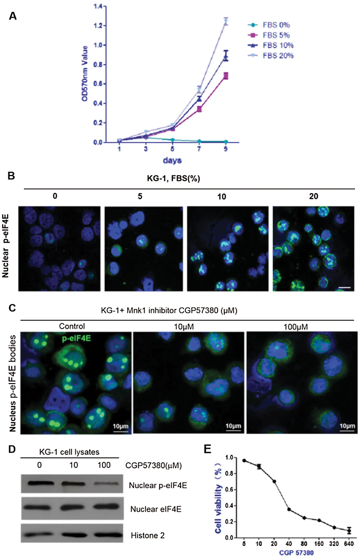 Elevated nuclear phospho-eIF4E body levels are associated with tumor ...