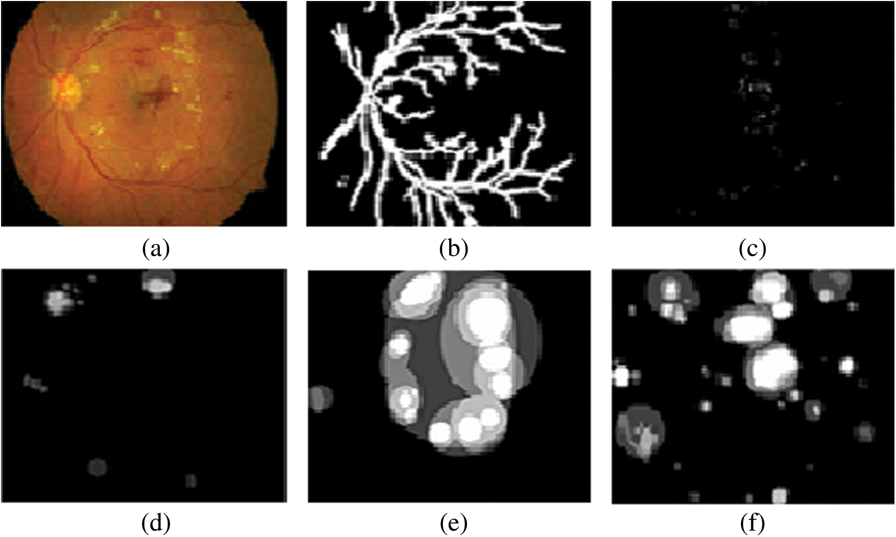 A Convolutional Neural Network Classifier VGG-19 Architecture for Lesion Detection and Grading ...