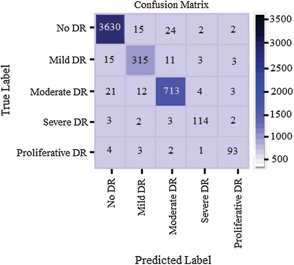 A Convolutional Neural Network Classifier VGG-19 Architecture for ...