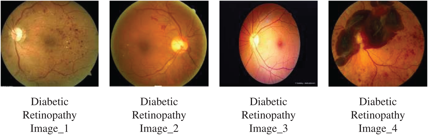 Intelligent Tunicate Swarm-Optimization-Algorithm-Based Lightweight ...