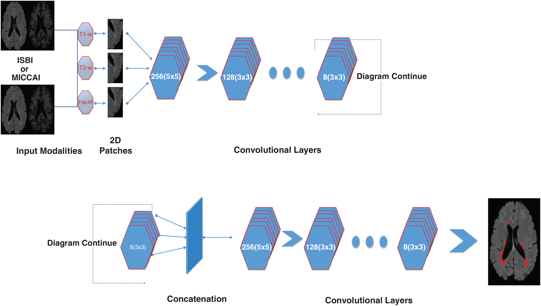 Automatic and Robust Segmentation of Multiple Sclerosis Lesions with Convolutional Neural Networks