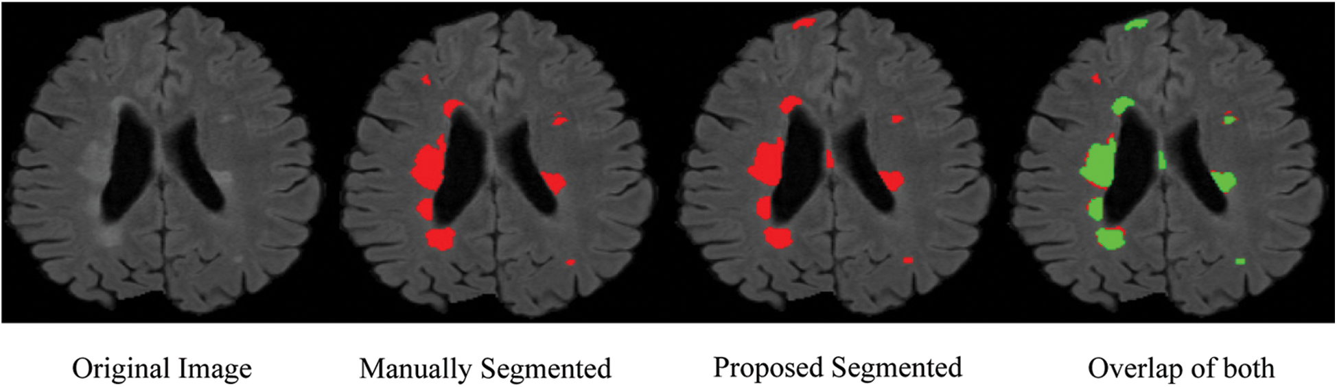 Automatic and Robust Segmentation of Multiple Sclerosis Lesions with Convolutional Neural Networks