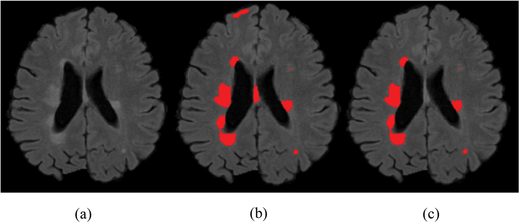 Automatic and Robust Segmentation of Multiple Sclerosis Lesions with Convolutional Neural Networks