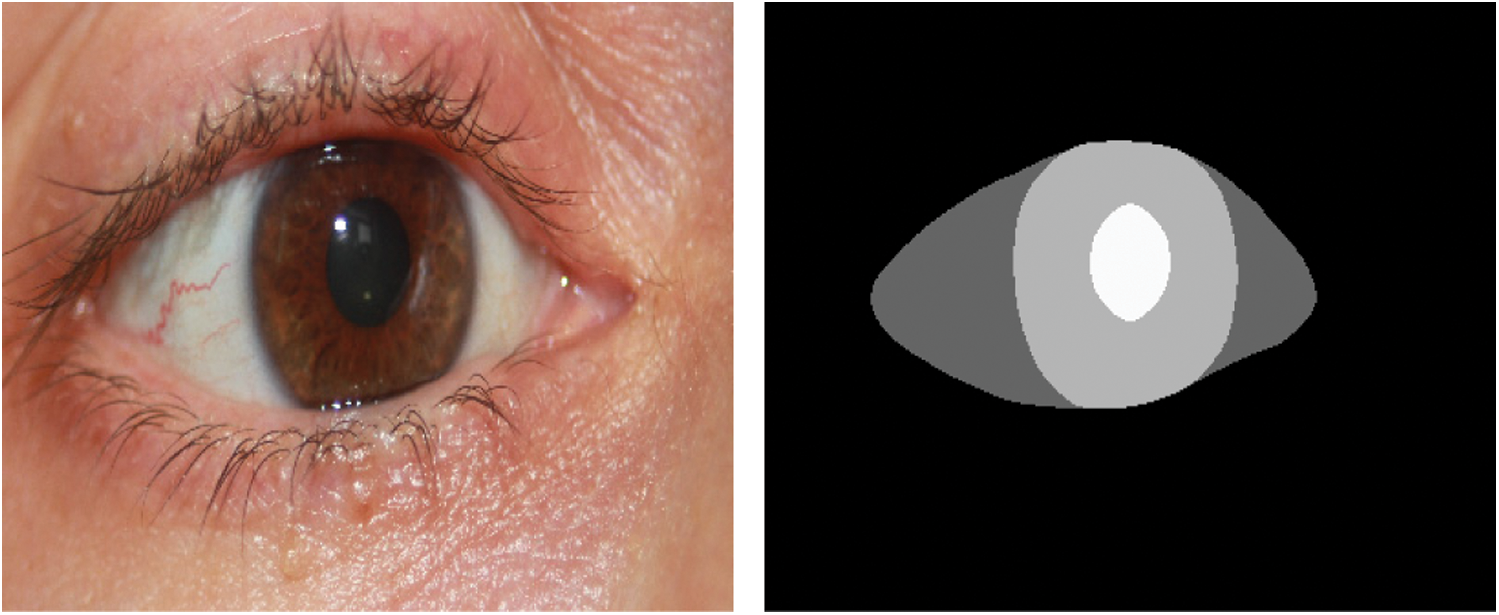 Artificial Intelligence-Based Semantic Segmentation of Ocular Regions ...
