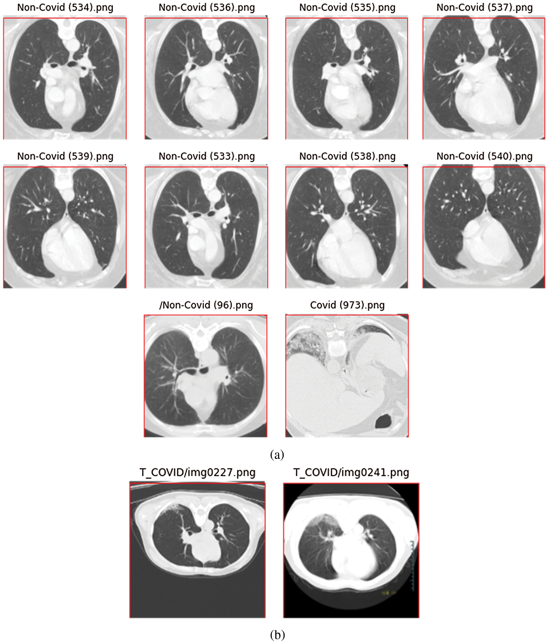 CNN Ensemble Approach to Detect COVID-19 from Computed Tomography Chest ...