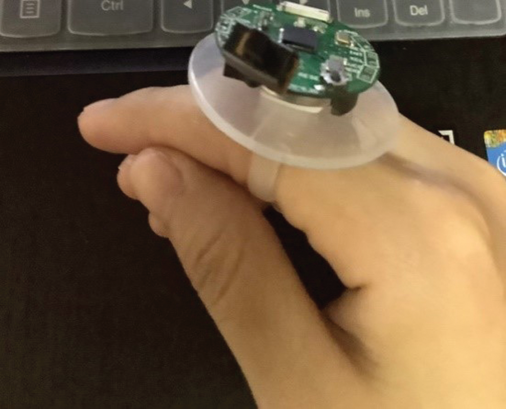 A Smart Wearable Ring Device for Sensing Hand Tremor of Parkinson’s ...