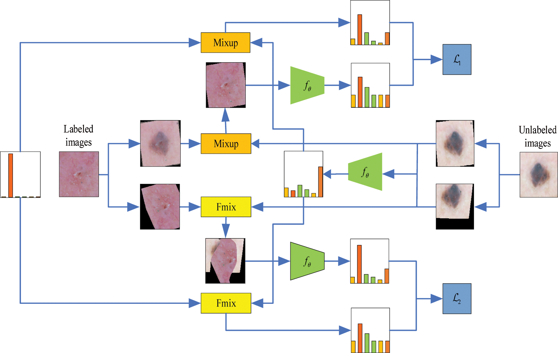 Mixed Re-Sampled Class-Imbalanced Semi-Supervised Learning for Skin Lesion Classification