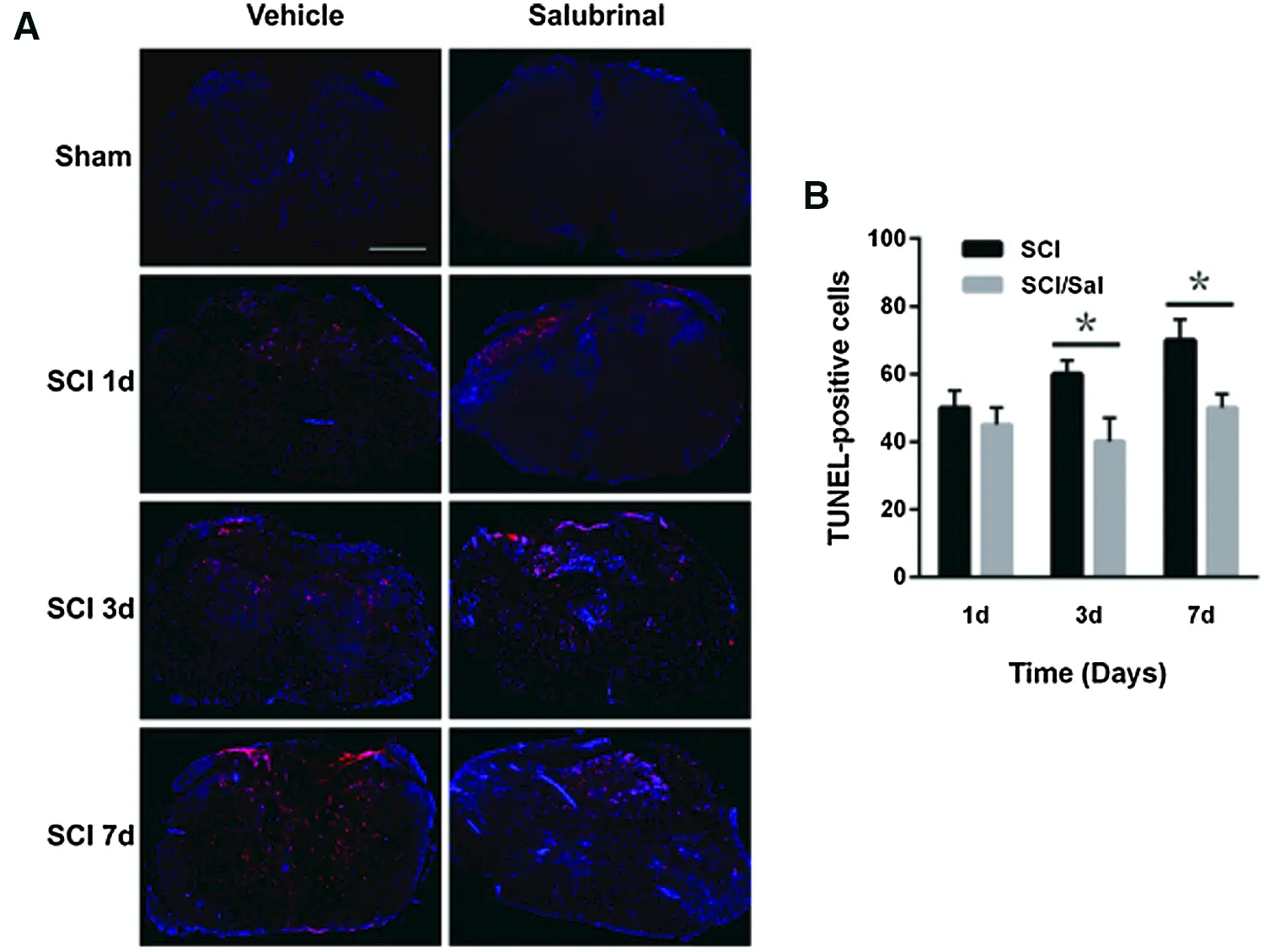Salubrinal alleviates traumatic spinal cord injury through suppression ...