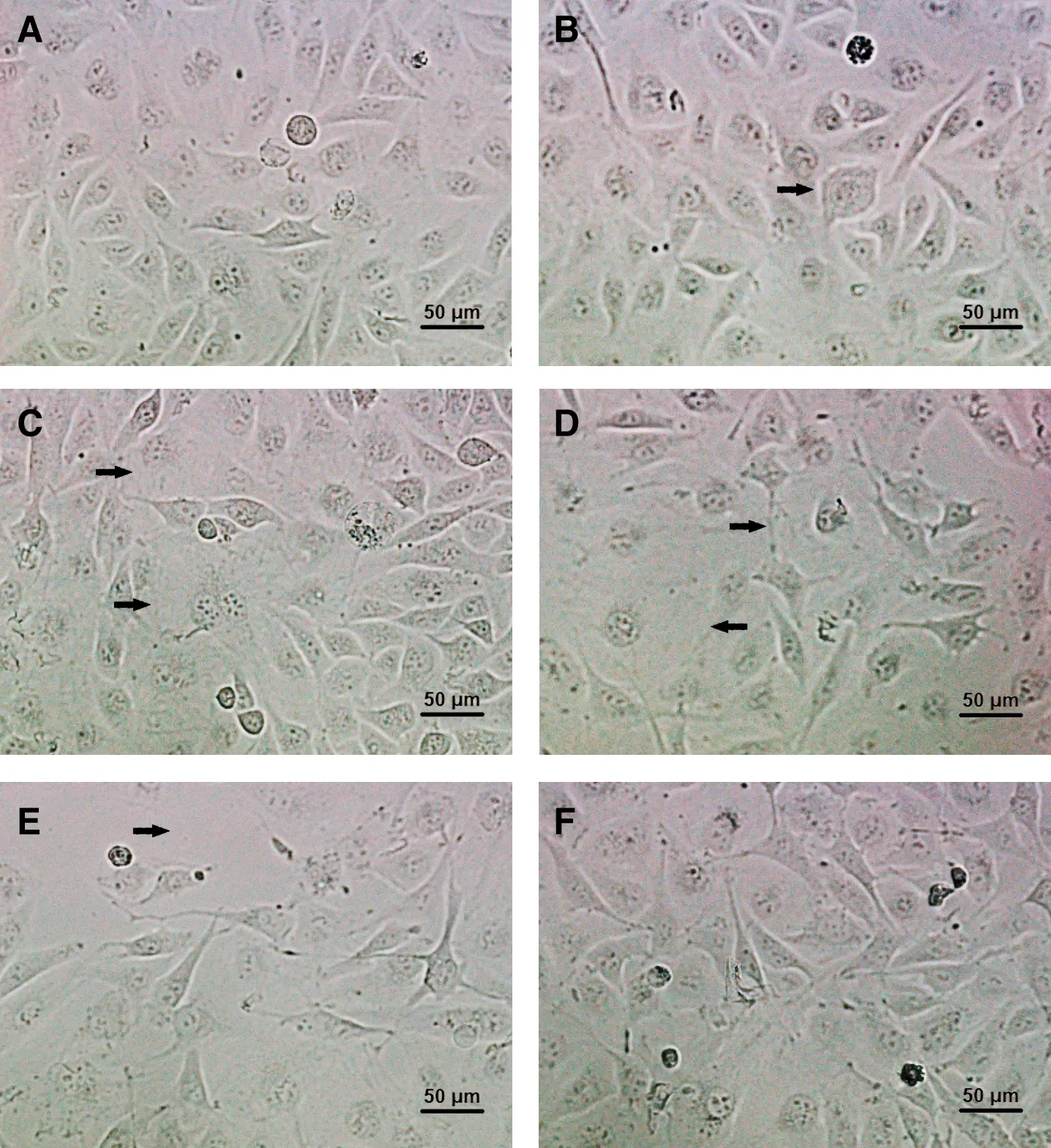 Divicine induces endothelial cells injury and its potential mechanism