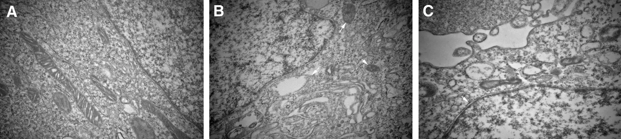 Divicine induces endothelial cells injury and its potential mechanism