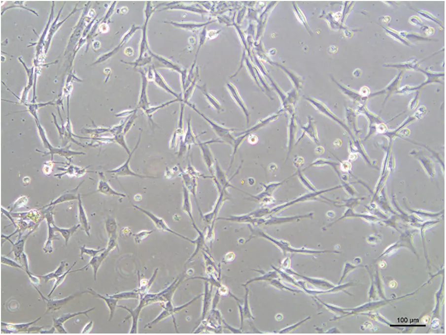Transplantation of BMP-7 gene-transfected bone marrow mesenchymal stem ...