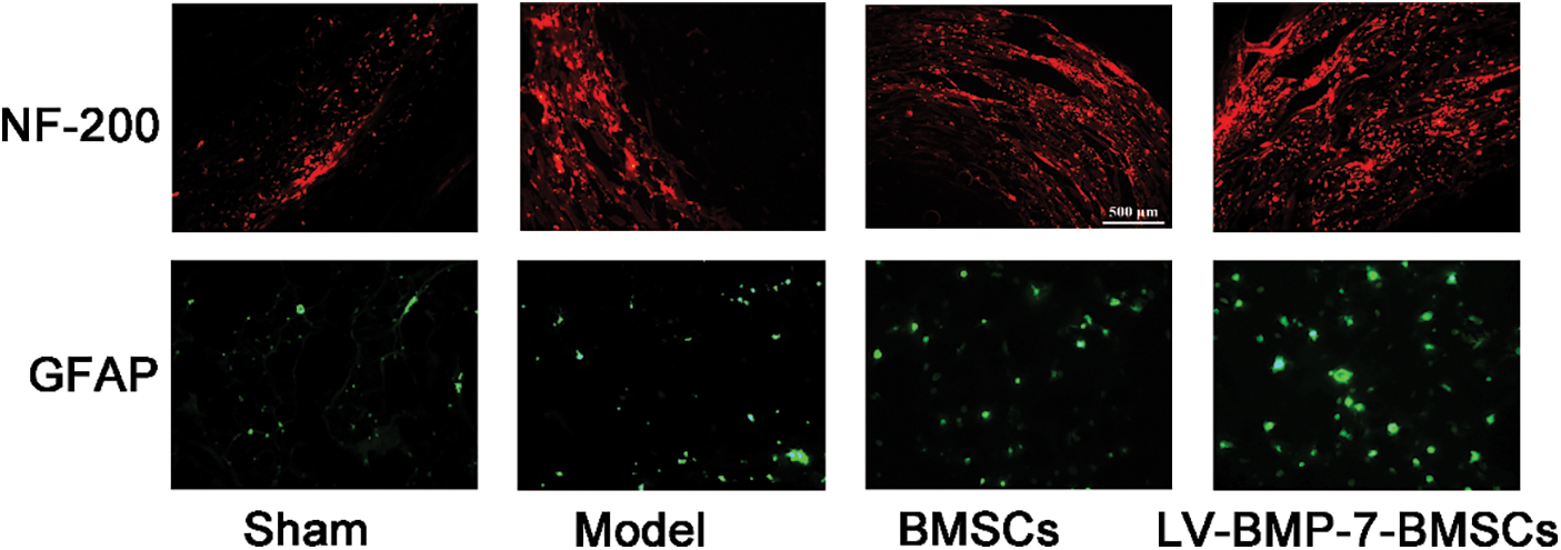 Transplantation of BMP-7 gene-transfected bone marrow mesenchymal stem ...