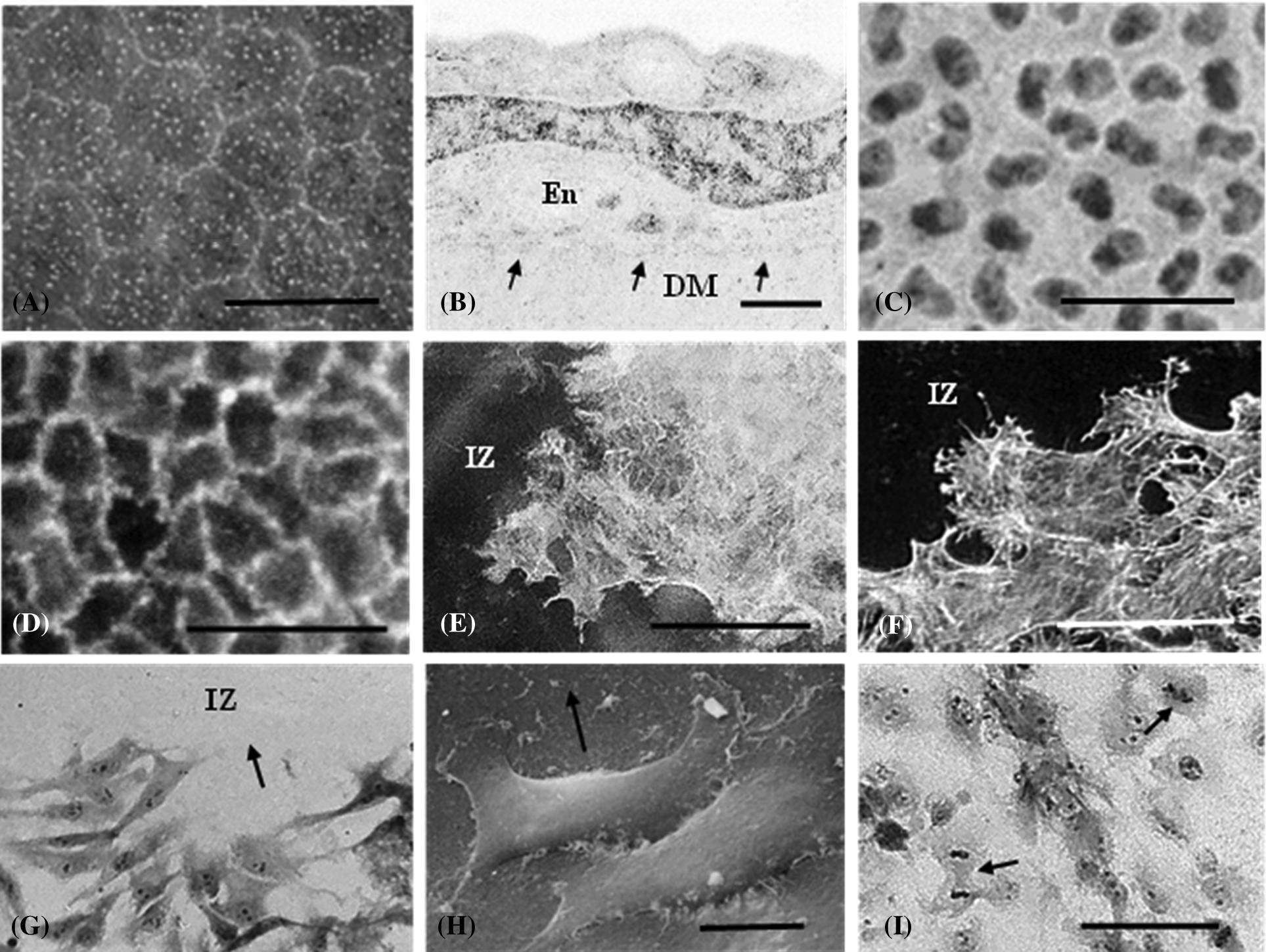 Dancing to a somewhat different rhythm: Cell migration along the ...