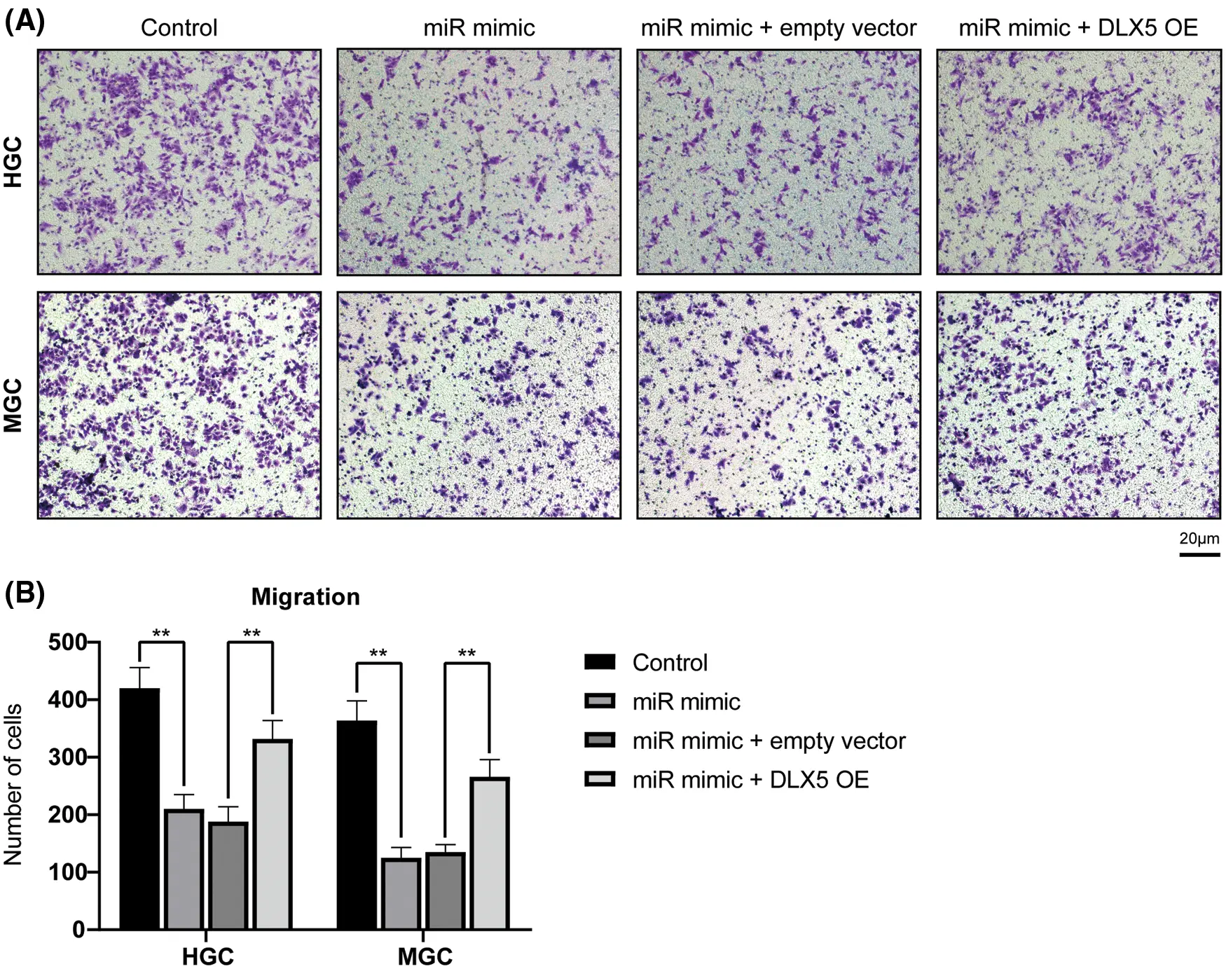 The expression and function of miR-376a-3p/DLX axis in gastric cancer cells