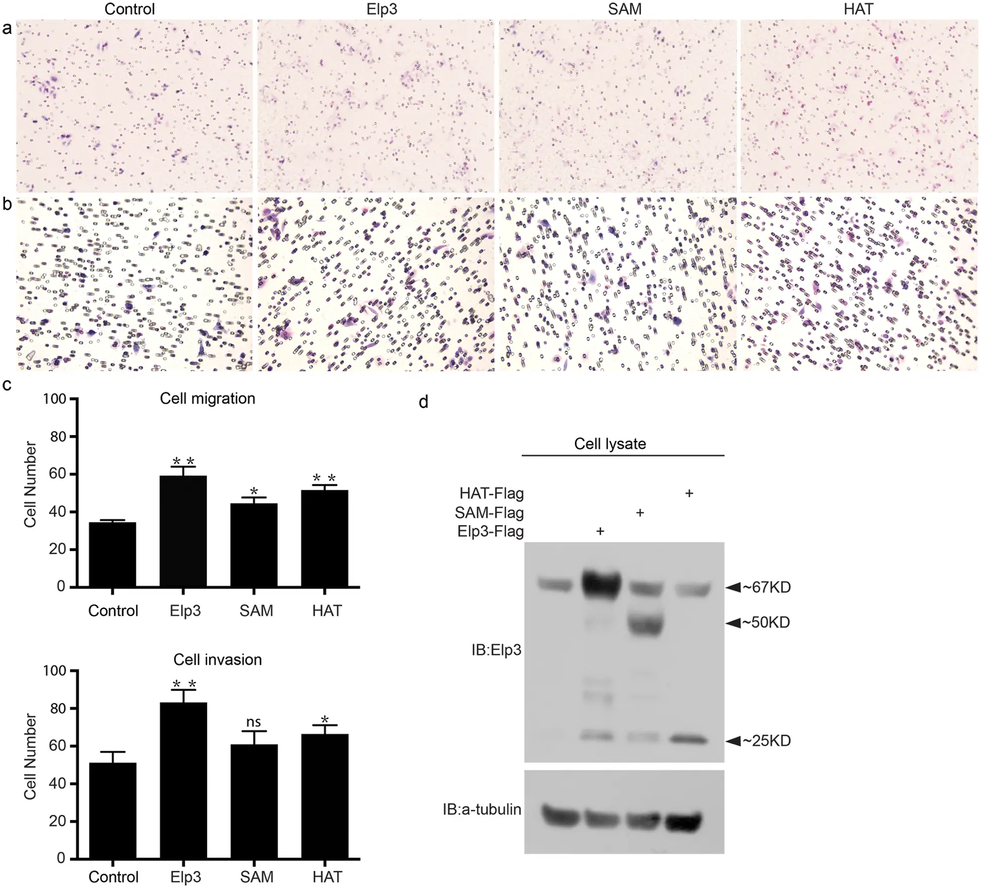 Elp3 modulates neural crest and colorectal cancer migration requiring ...